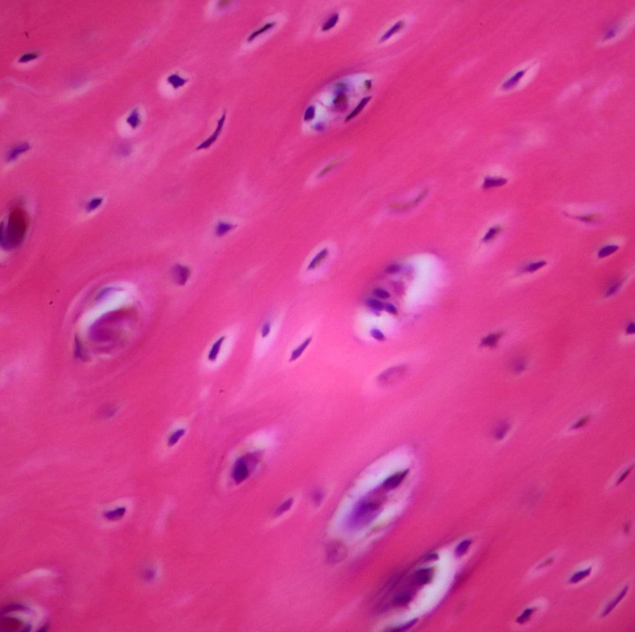 Connective Tissue Types Microscope Slide Set