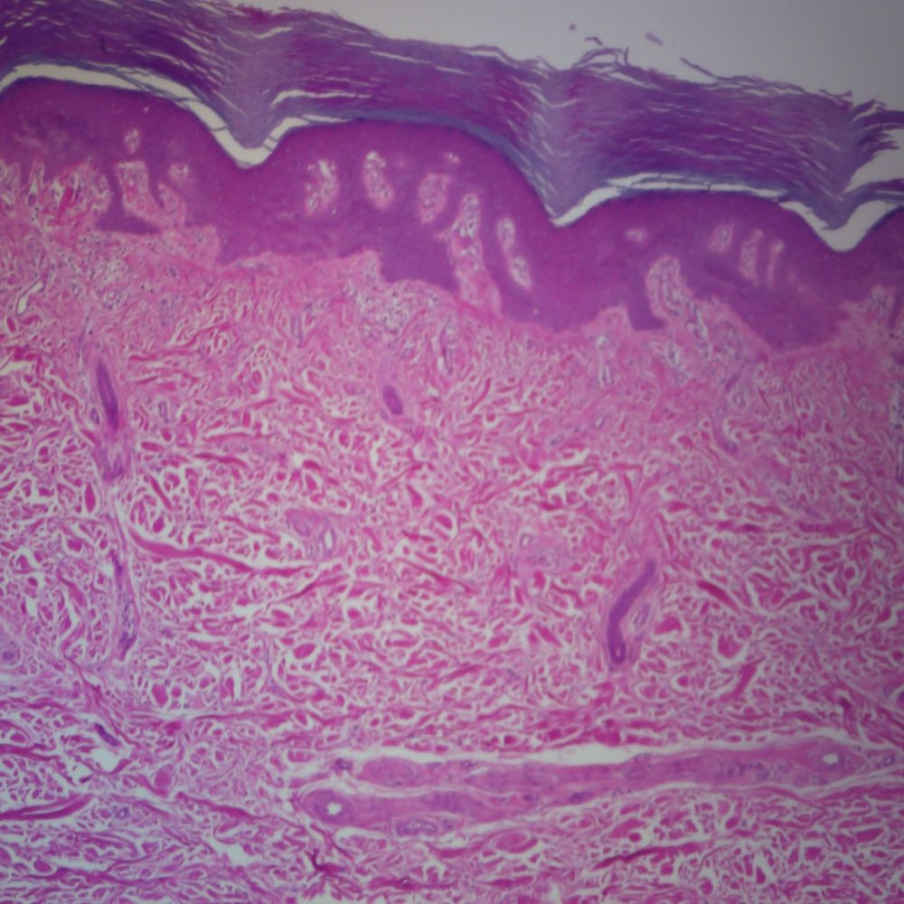 Types of Skin Microscope Slide Set