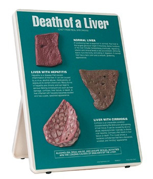 Death Of A Liver Easel Display - Southern Biological