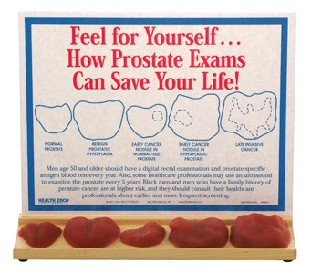Feel For Yourself: Prostate Conditions Display - Southern Biological