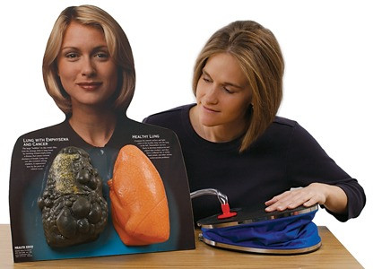 Lou-Wheeze Smoker'S Lungs Comparison Model - Southern Biological