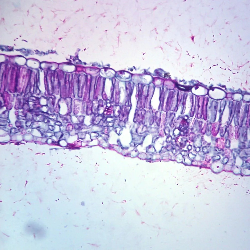 Lilac Mildew, section Microsphaera, Microscope Slide - Southern Biological
