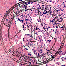Placenta, section, H&E stain Microscope slide - Southern Biological