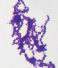 Streptococcus pyogenes, cocci, chains, wm Microscope slide - Southern ...