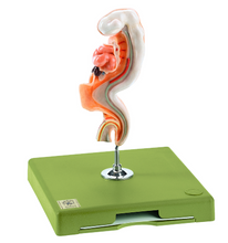 MS48/3-1 - Human embryo