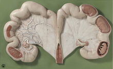 Zo20 - Uterus of the Pig with Fetus