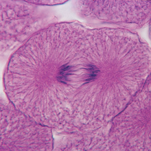 Beginner's Biology Microscope Slide Set