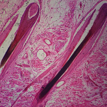 Types of Skin Microscope Slide Set