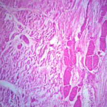 Cardiovascular Diseases Microscope Slide Set