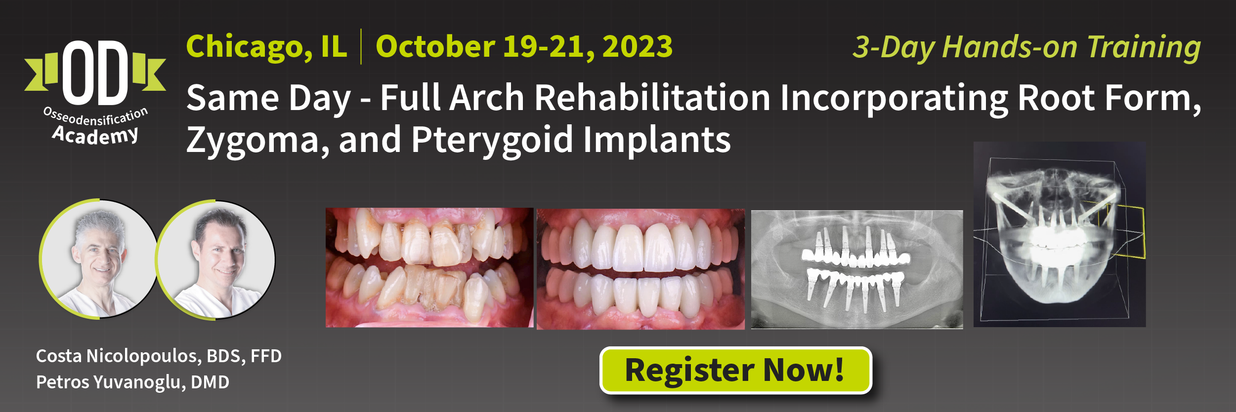 The Osseodensification Company | Versah