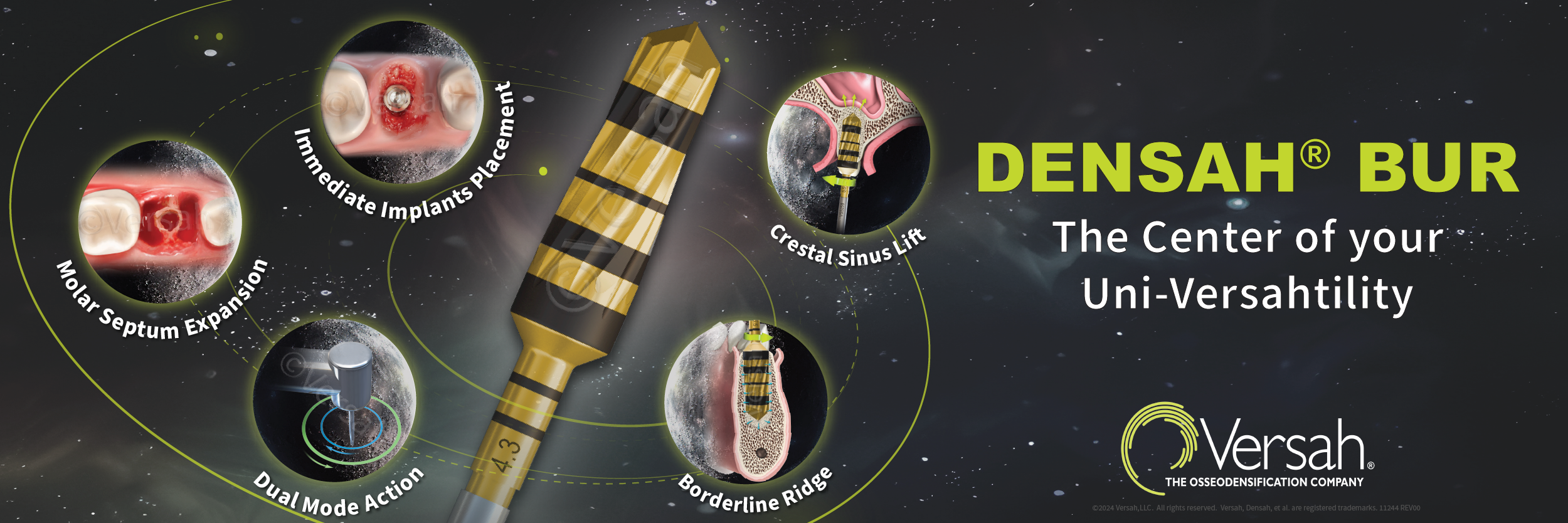 The Osseodensification Company | Versah