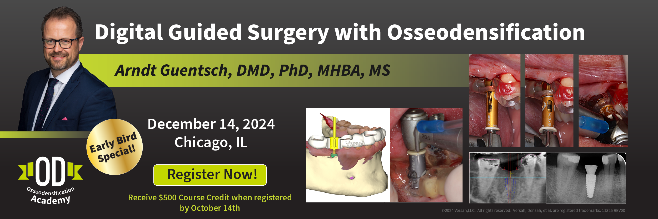 The Osseodensification Company | Versah