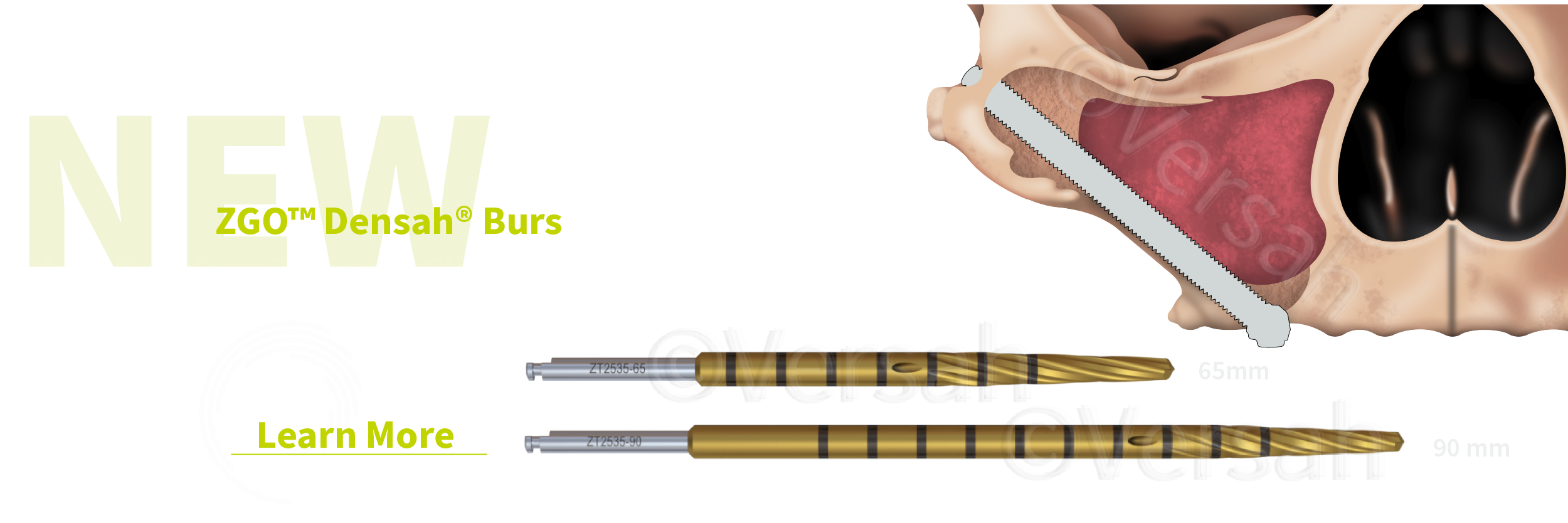 The Osseodensification Company | Versah