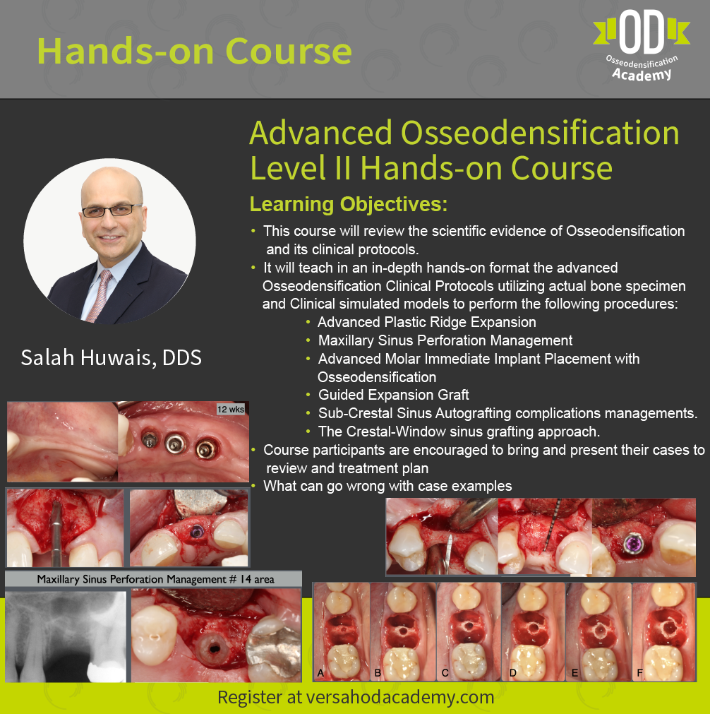 Densah Burs and Densah Bur Kits | Versah LLC