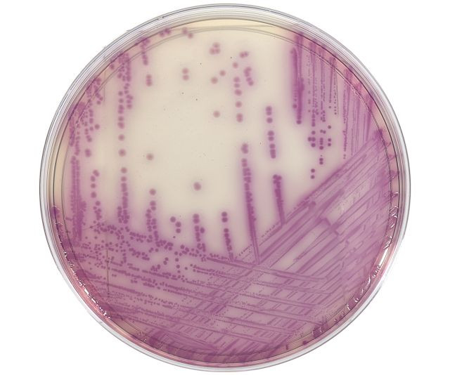 HardyCHROM™ Salmonella, Chromogenic Medium, 15x100mm, Pack of 10 Plates