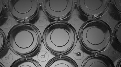 35mm dish with glass bottom for confocal and other types of microscopy