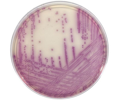 HardyCHROM™ Salmonella, Chromogenic Medium, 15x100mm, Pack of 10 Plates