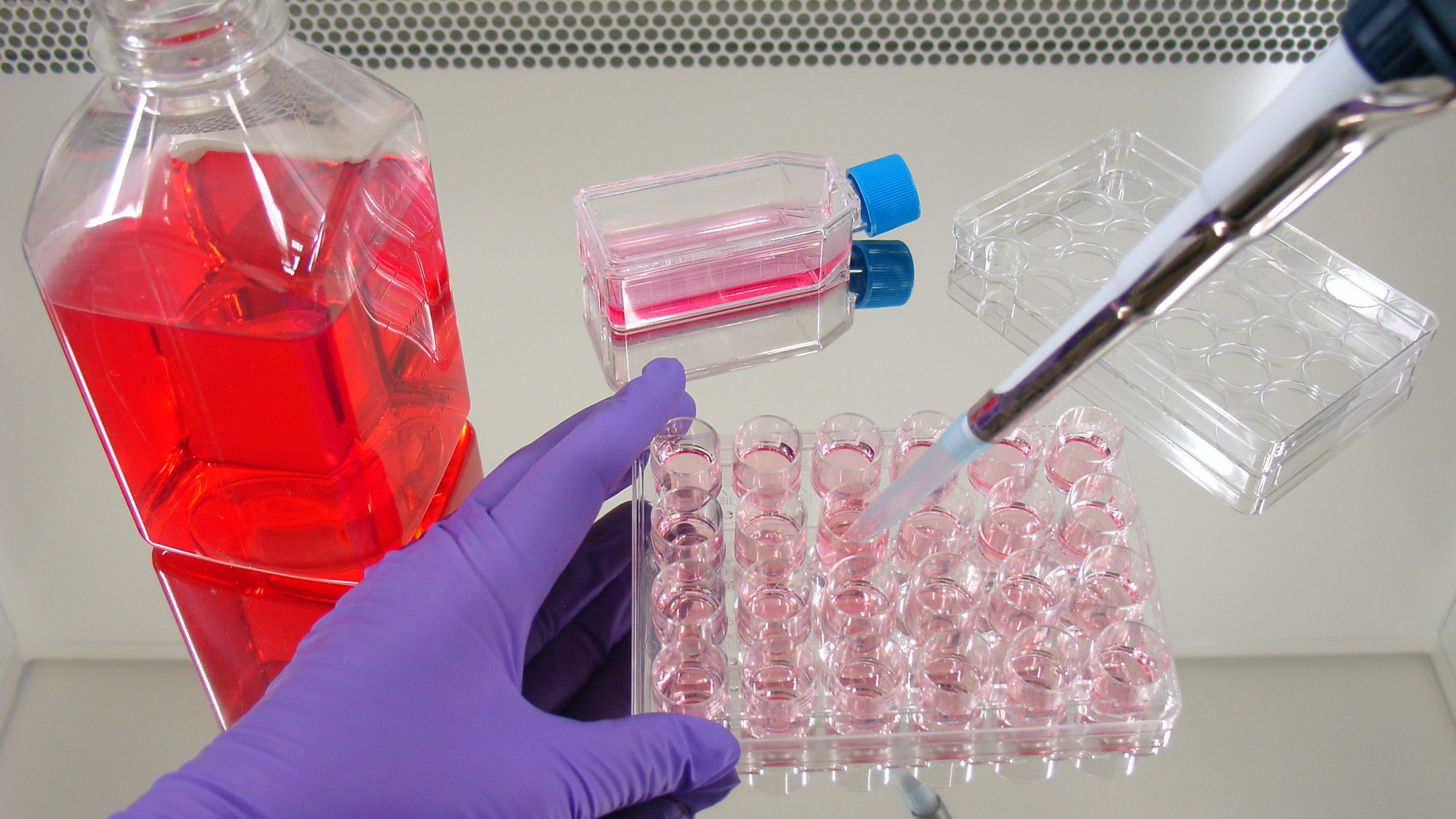 CHOANOCYTES –COLLAR CELLS