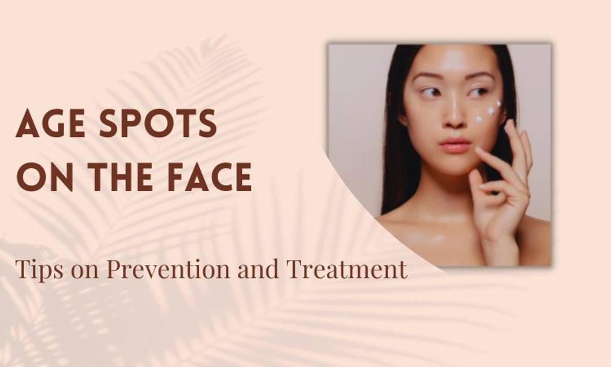 Age Spots On The Face: Tips on Prevention and Treatment - Skin Beauty