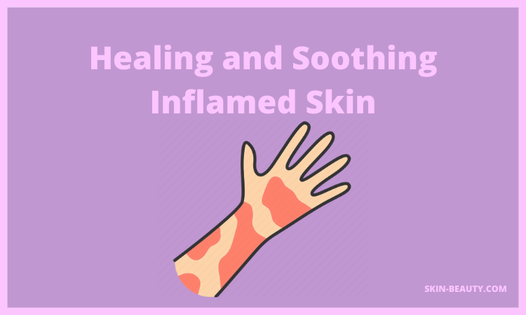 Healing and Soothing Inflamed Red Skin - Skin Beauty