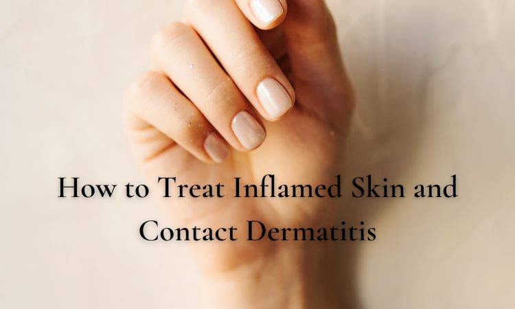 How to Treat Inflamed Skin and Contact Dermatitis - Skin Beauty