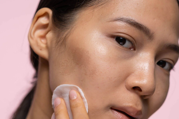 The Best Skin Care Ingredients for Hyperpigmentation - Skin Beauty