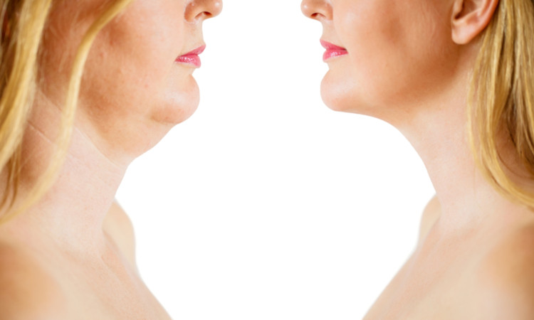 Best Products To Firm Skin On The Neck - Skin Beauty