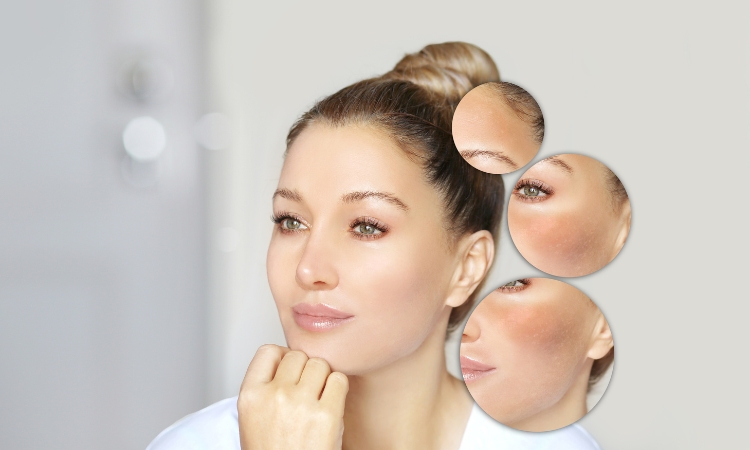 How to Protect and Repair Your Damaged Skin Barrier - Skin Beauty