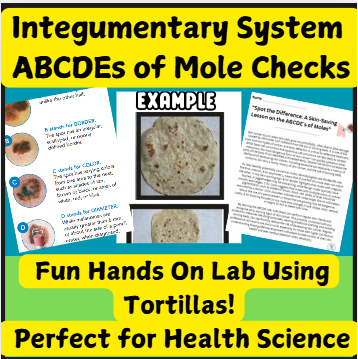 Health Science Integumentary System ABCDEs of Mole Checks Lab Using ...