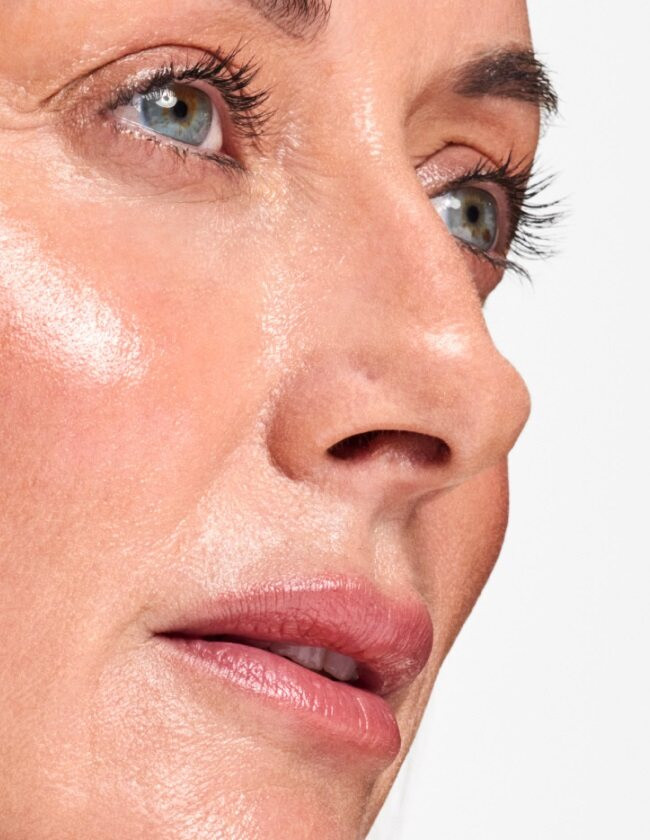 Laser Vascular Lesion Removal