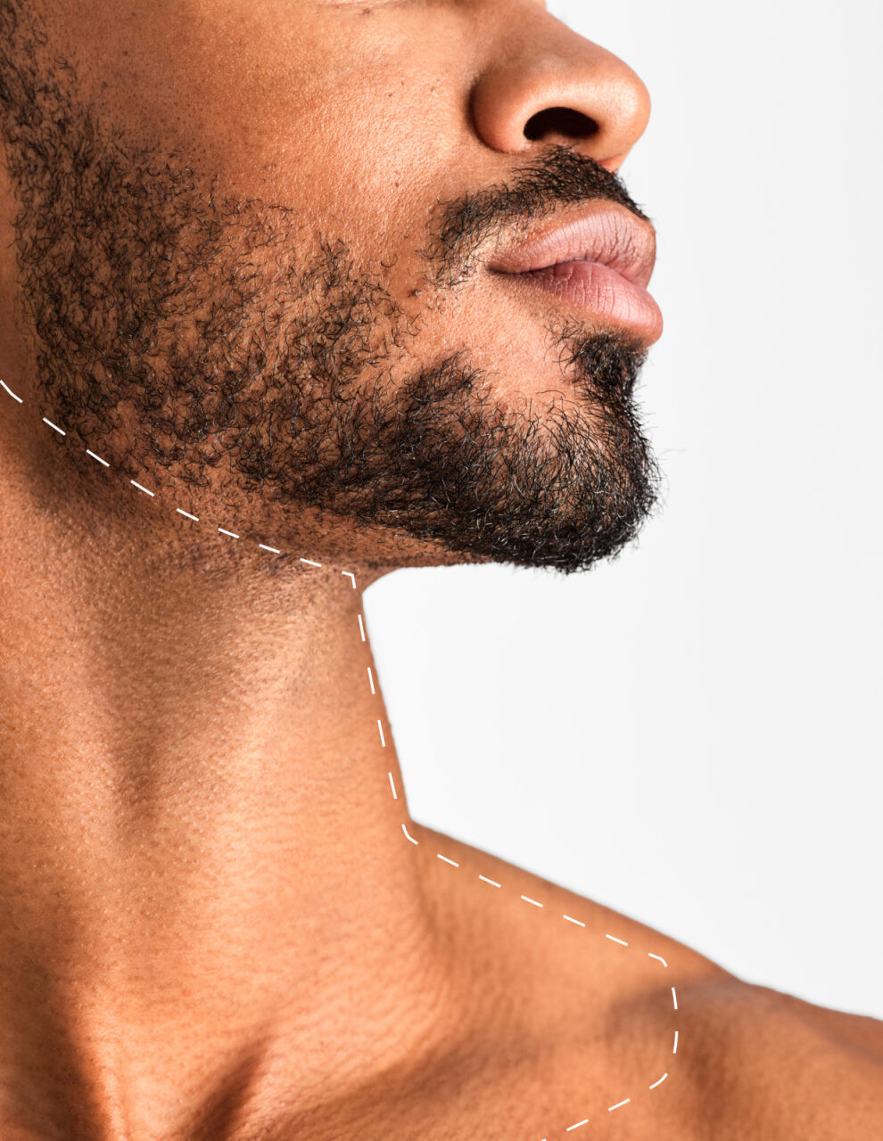 Laser Hair Removal Front of Neck | Laser Clinics New Zealand