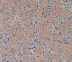 Podocin (PDCN) Polyclonal Antibody, Cat#CAU26802 - Biomatik