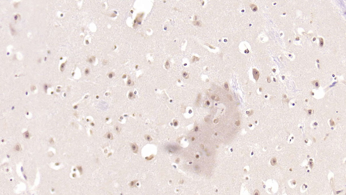 Mesencephalic Astrocyte Derived Neurotrophic Factor (MANF) Monoclonal ...