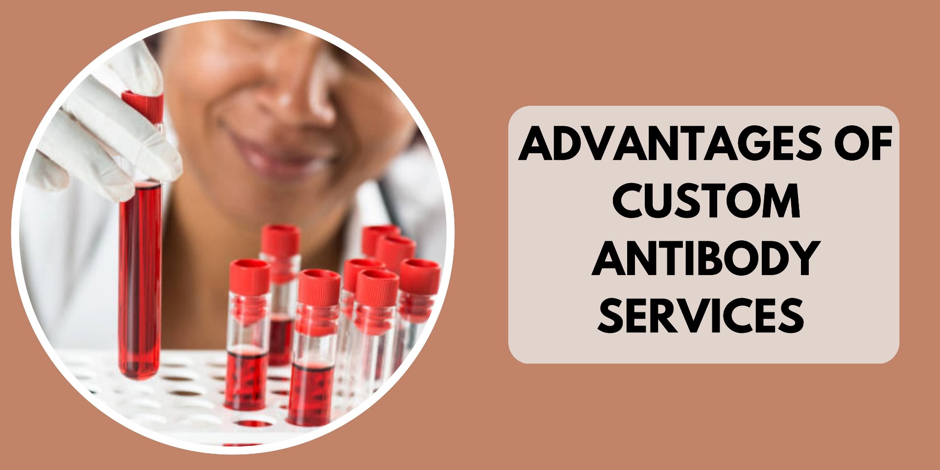 Advantages of Custom Antibody Services - Biomatik