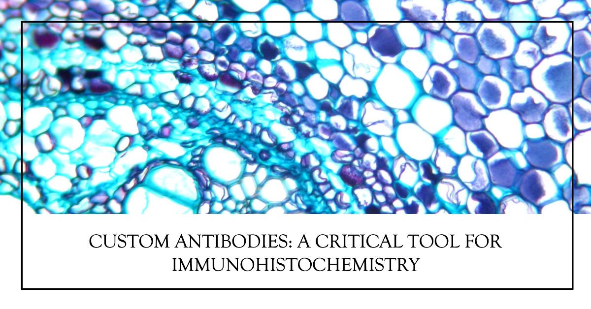 Custom Antibodies: A Critical Tool For Immunohistochemistry - Biomatik