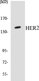 HER2 ELISA Kit, Cat#EKA50281 - Biomatik