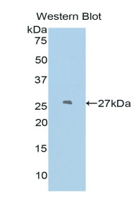 Podocin (PDCN) Polyclonal Antibody, Cat#CAU26802 - Biomatik