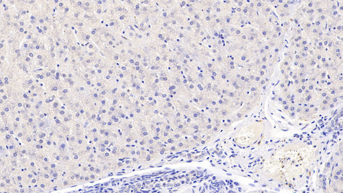 Complement Factor B (CFB) Polyclonal Antibody, Cat#CAU32876 - Biomatik