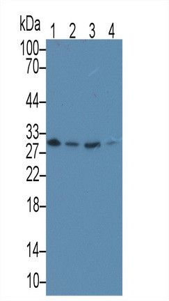 Microtubule Associated Protein RP/EB Family, Member 1 (MAPRE1 ...