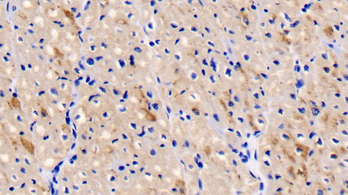 Troponin T Type 2, Cardiac (TNNT2) Monoclonal Antibody, Cat#CAU33713 ...
