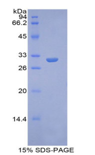 Recombinant Human Glypican 4 (GPC4), Cat#RPU41717 - Biomatik