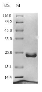 Recombinant Human Ragulator complex protein LAMTOR1 (LAMTOR1), Cat# ...