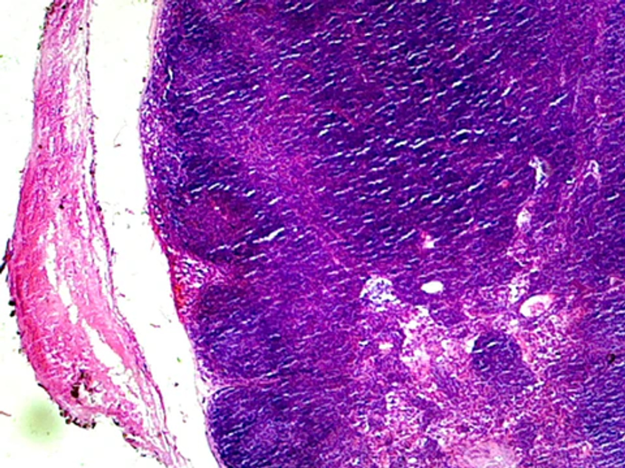 Prepared Microscope Slide Lymph Node Mammalian Section