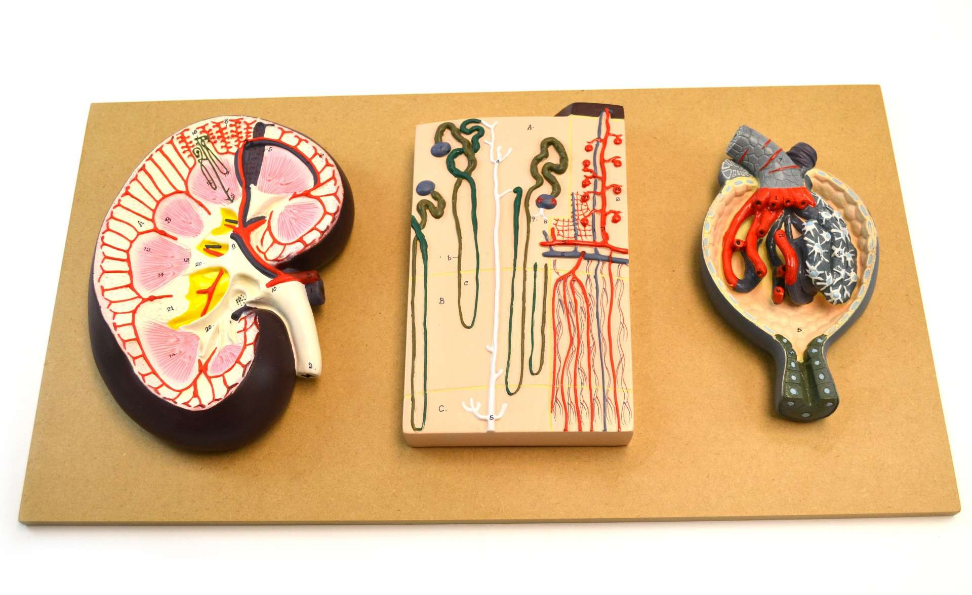 Human Kidney Section Model; 3X Life | Geyer Instructional Products