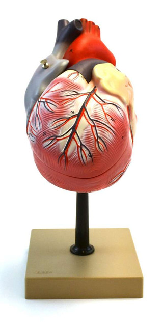 Human Heart Conditions Pathology Model | Geyer Instructional Products