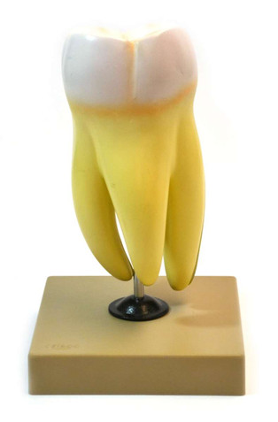 Human Upper Triple Root Molar with Interchangeable Cavities | Geyer ...