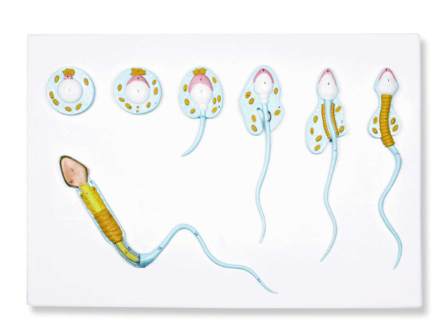 Tapeworm / Taenia - Solium model | Geyer Instructional Products