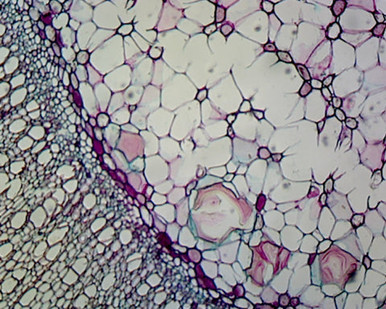 Prepared Microscope Slide, Basswood (Tilia) Two Years Stem; Cross Section