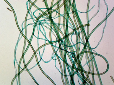 Prepared Microscope Slide, Linen Textile Fibers; Whole-mount