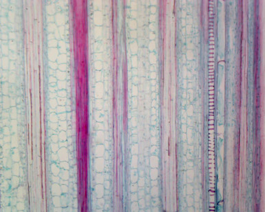 Prepared Microscope Slide with Specimen showing Zea Mays (Corn) Stem ...